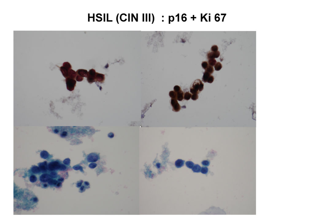 CINtec PLUS- naše skúsenosti – NewsLab – Odborný časopis laboratórnej ...