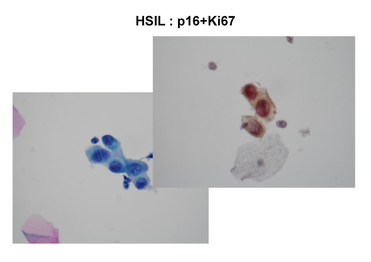 CINtec PLUS- naše skúsenosti – NewsLab – Odborný časopis laboratórnej ...